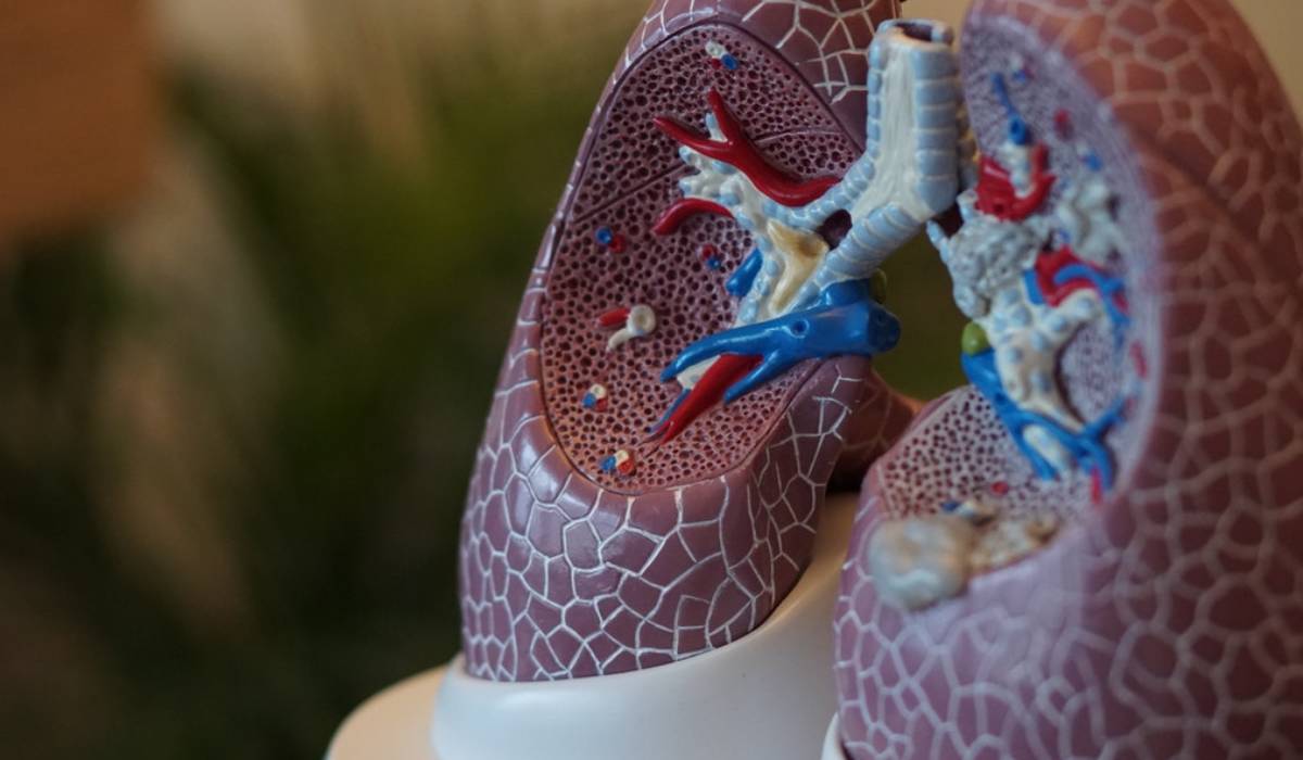 MedTech Strategist - BioTrace Medical: Serving a Growing TAVR Market ...